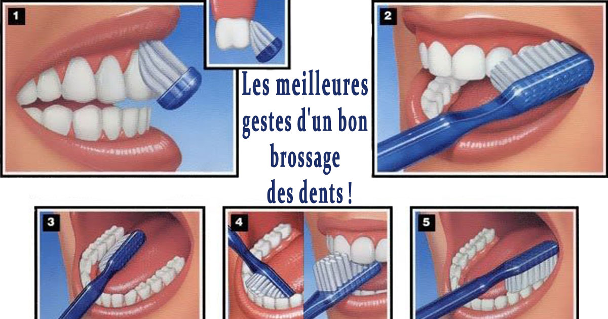 Les meilleures gestes d'un bon brossage des dents
