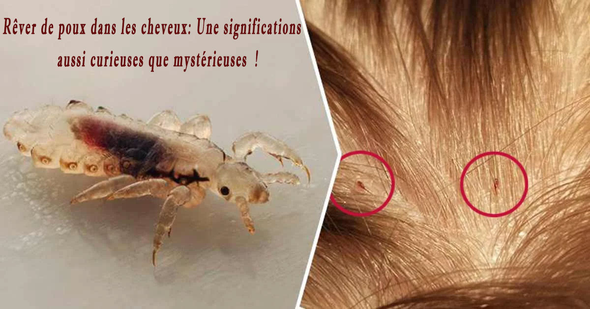 R ver De Poux Dans Les Cheveux Une Significations Aussi Curieuses Que