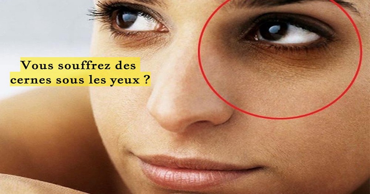 Vous souffrez des cernes sous les yeux
