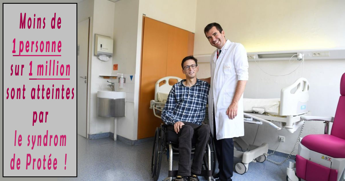 Moins de 1 personne sur 1 million sont atteintes par le syndrome de ...