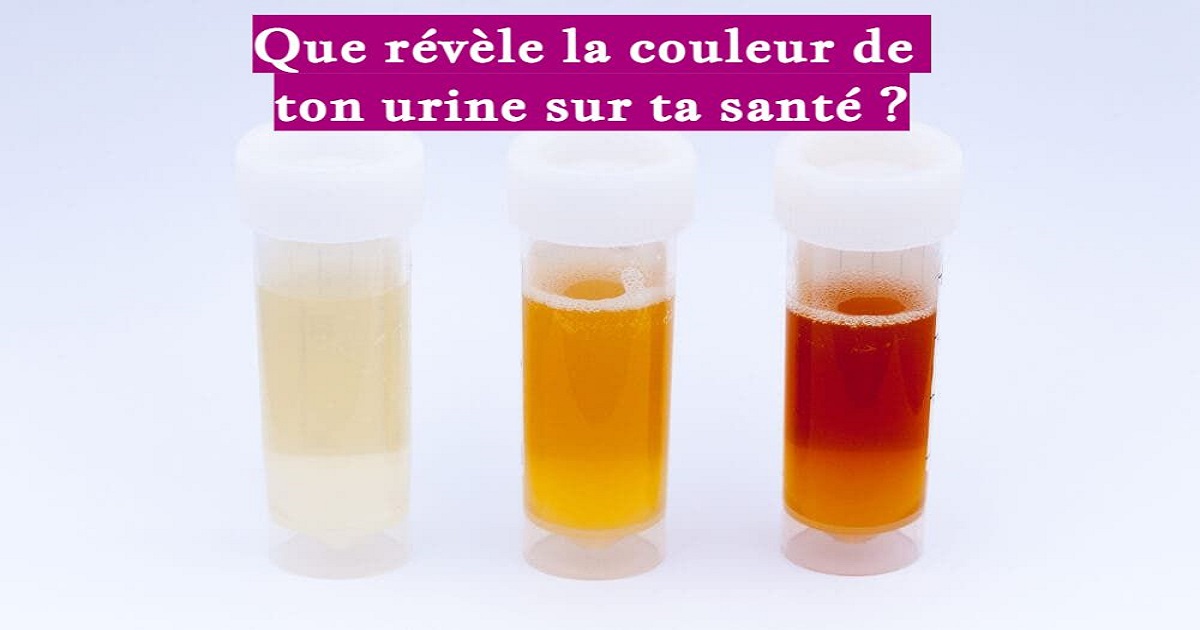 Que révèle la couleur de ton urine sur ta santé