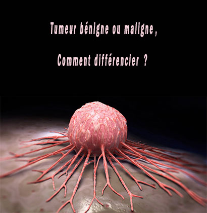 Tumeur bénigne ou maligne, Comment différencier